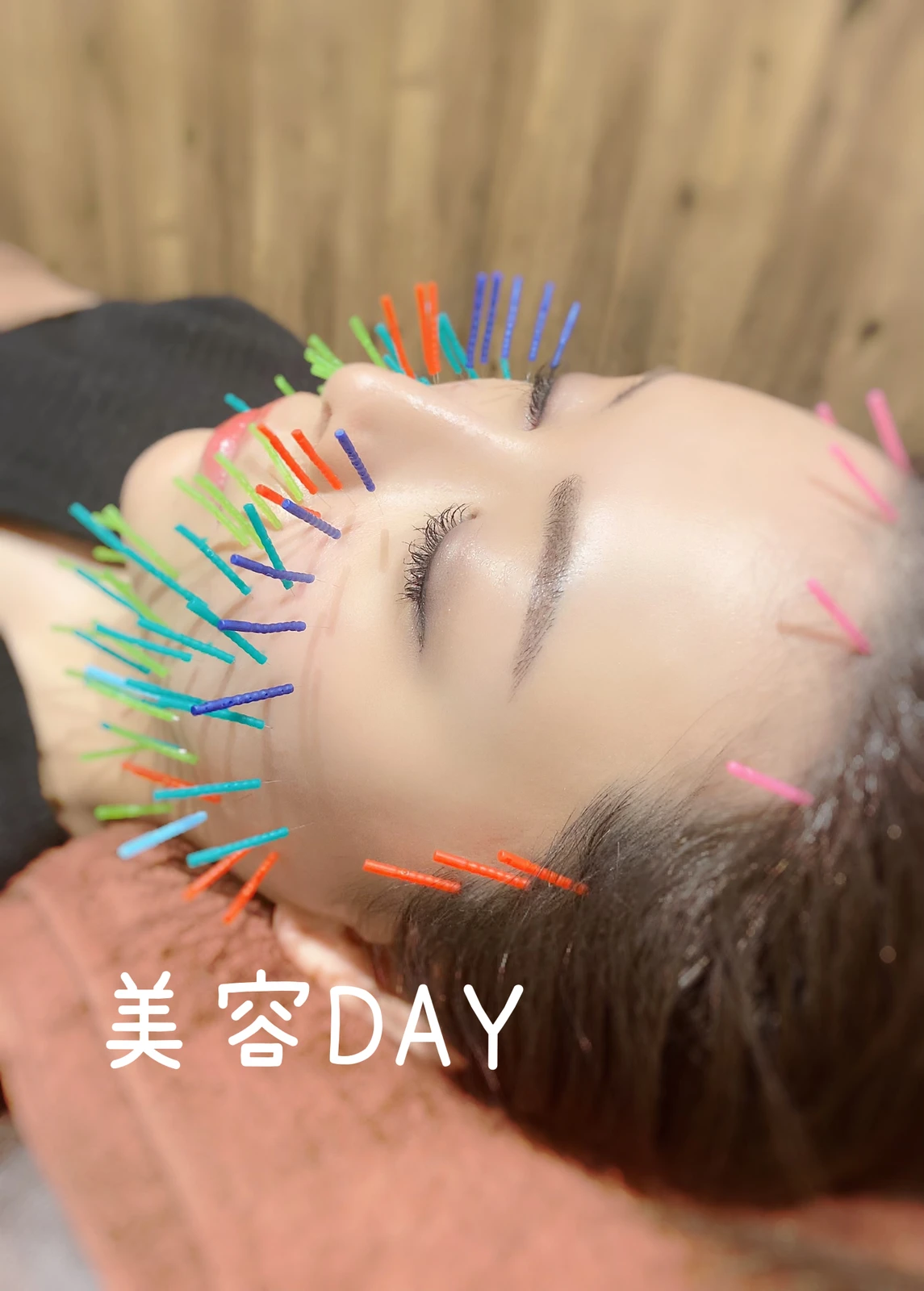 美容鍼💓 | _ayami.y_が投稿したフォトブック | Lemon8