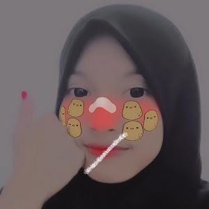 Evos_CERA's Post|Lemon8