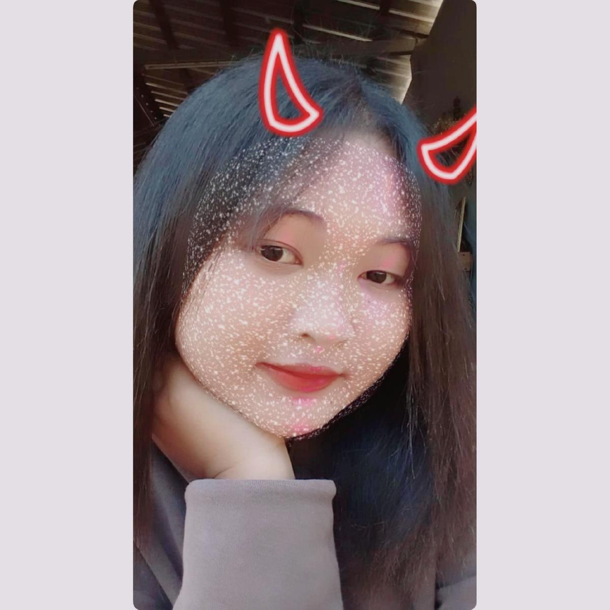 pare_01's Post|Lemon8