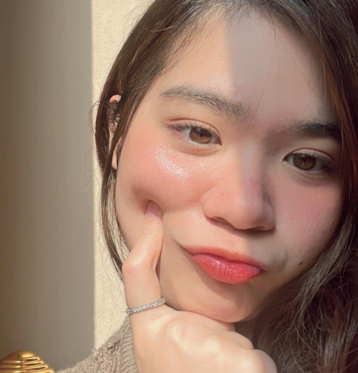 pdent.diary's Post|Lemon8