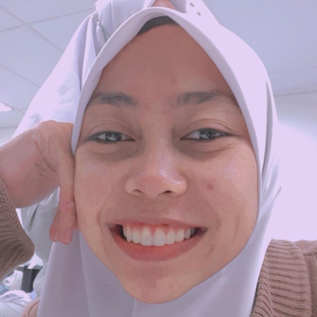 IsnaRo's Post|Lemon8