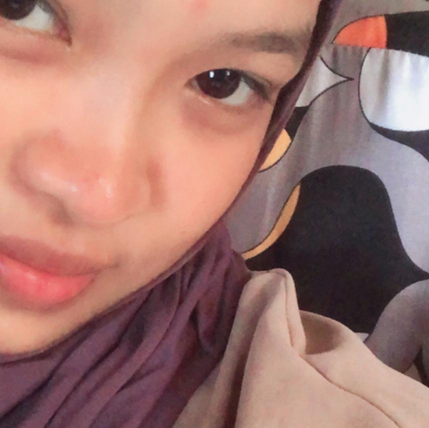 adilaizlinn's Post|Lemon8