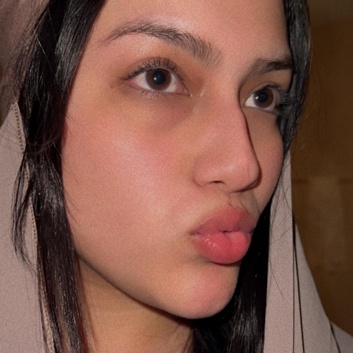 Ari ️🐰's Post|Lemon8