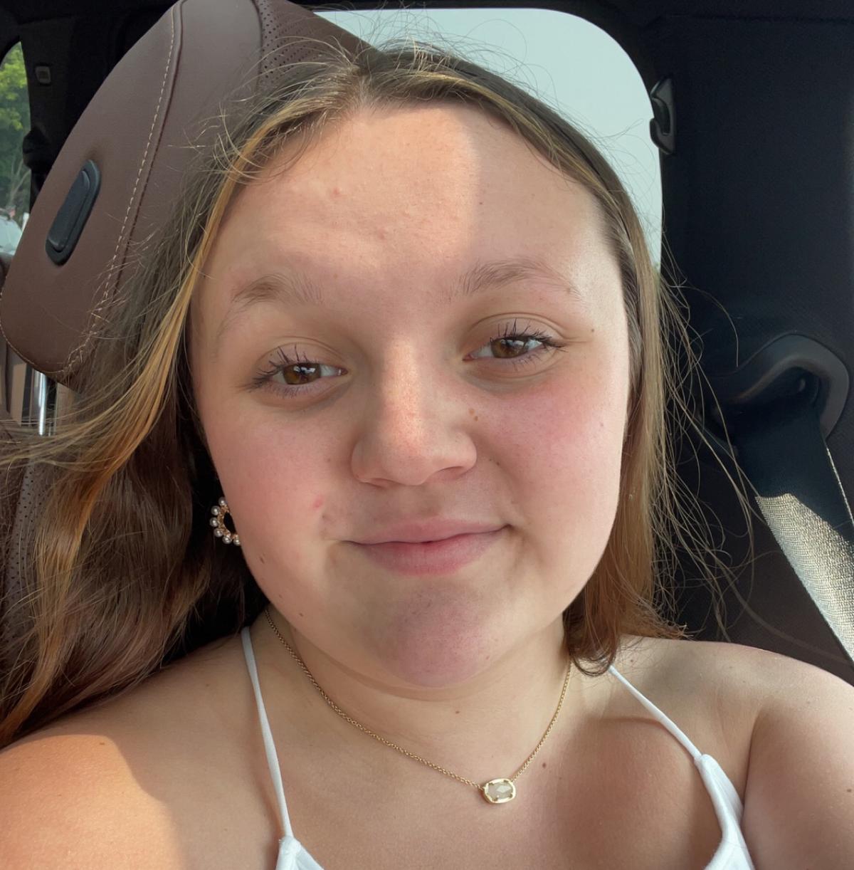 aly🌞's Post|Lemon8