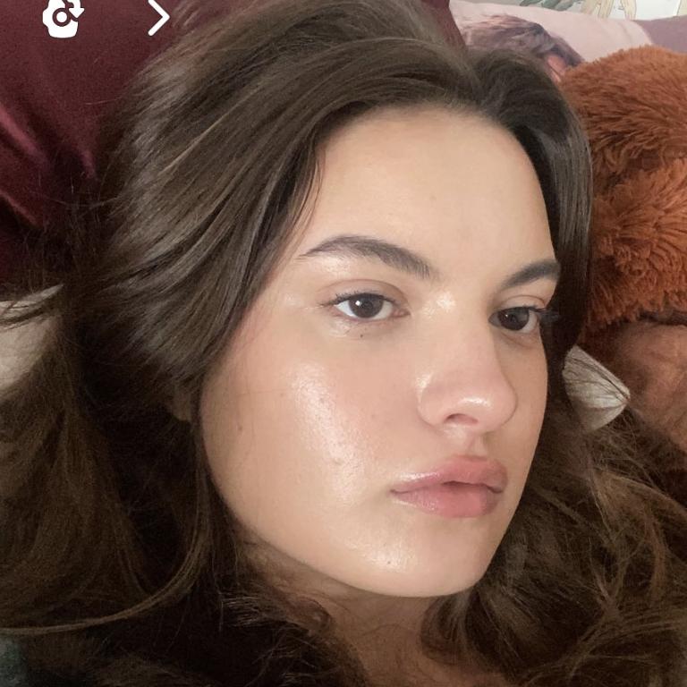 anne ̈'s Post|Lemon8