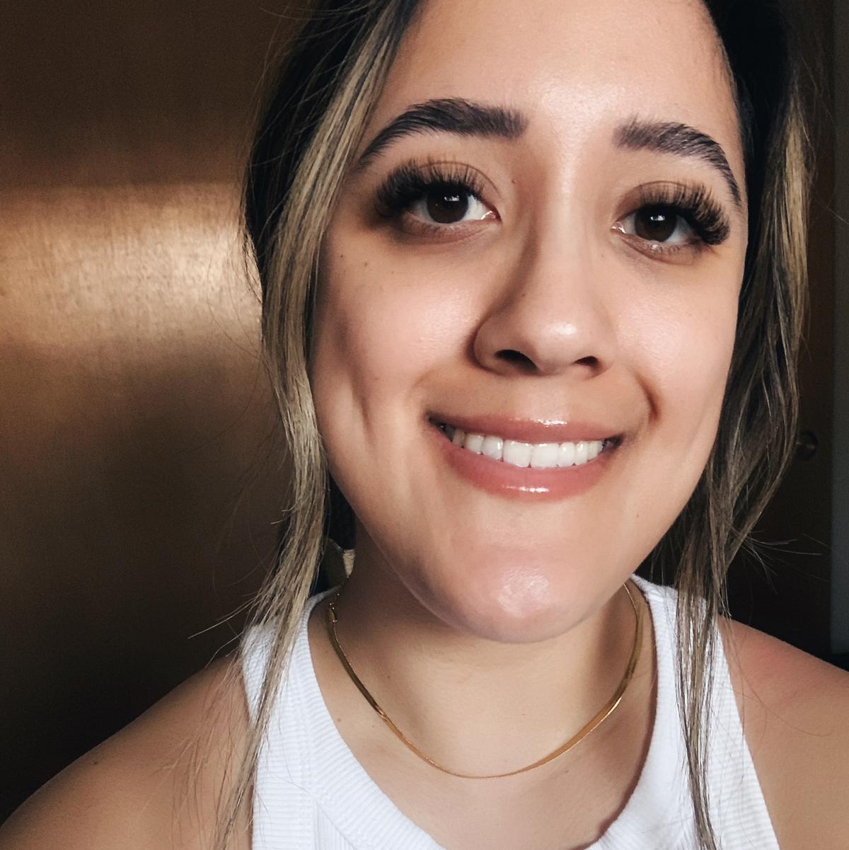 ALICIA s Post Lemon8