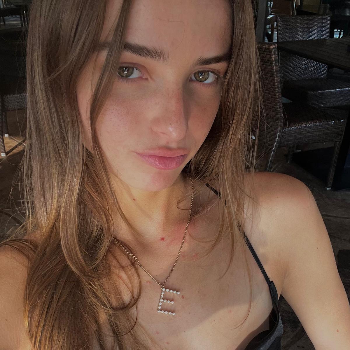 Emily Blumberg's Post|Lemon8