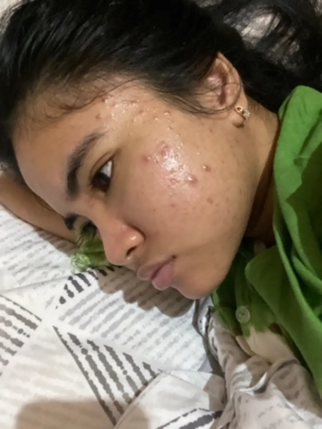 3 Cara Exfoliasi Wajah Agar Makin Glowing | Artikel diposting oleh Imelda Ayu | Lemon8