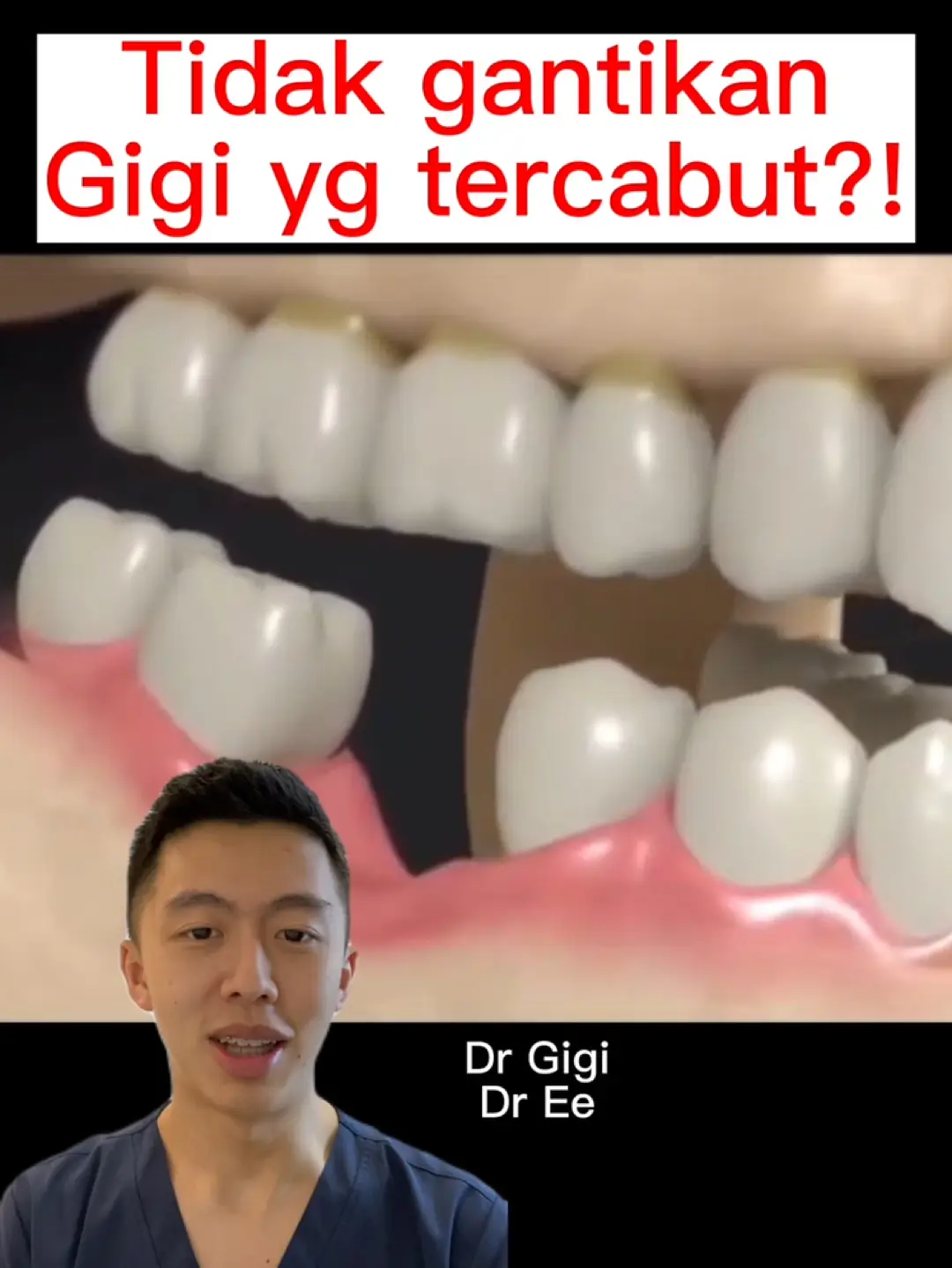 Siarkan Dr Gigi Dr Ee|Lemon8