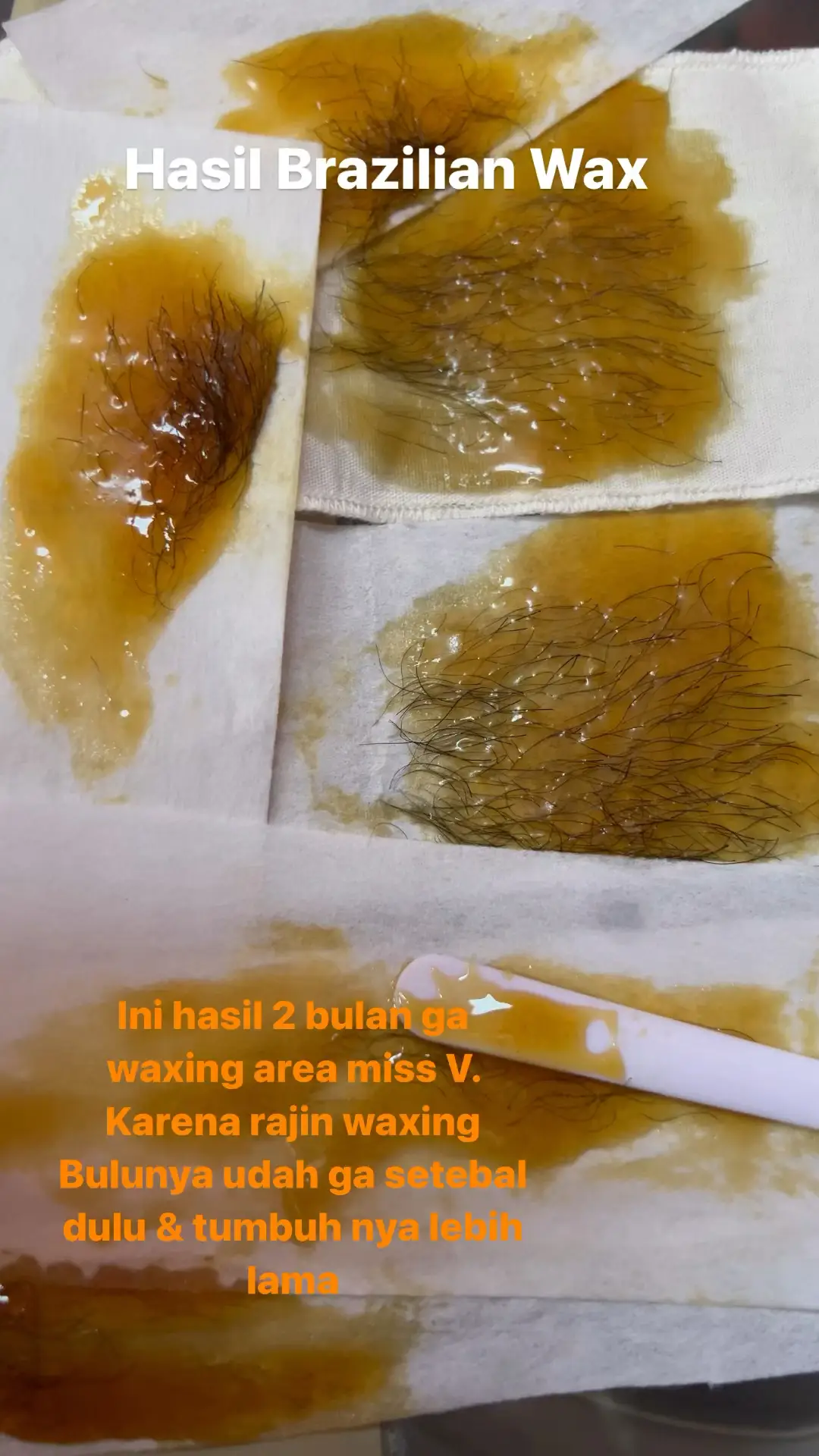 TIPS KECILIN HIDUNG (EASY) | Artikel diposting oleh jsscangelica | Lemon8